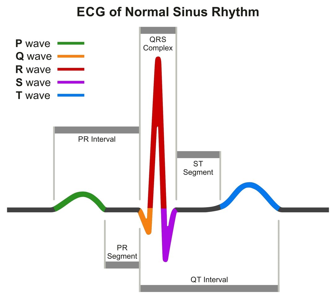 Sinus Rhythm - OT&P Knowledgebase