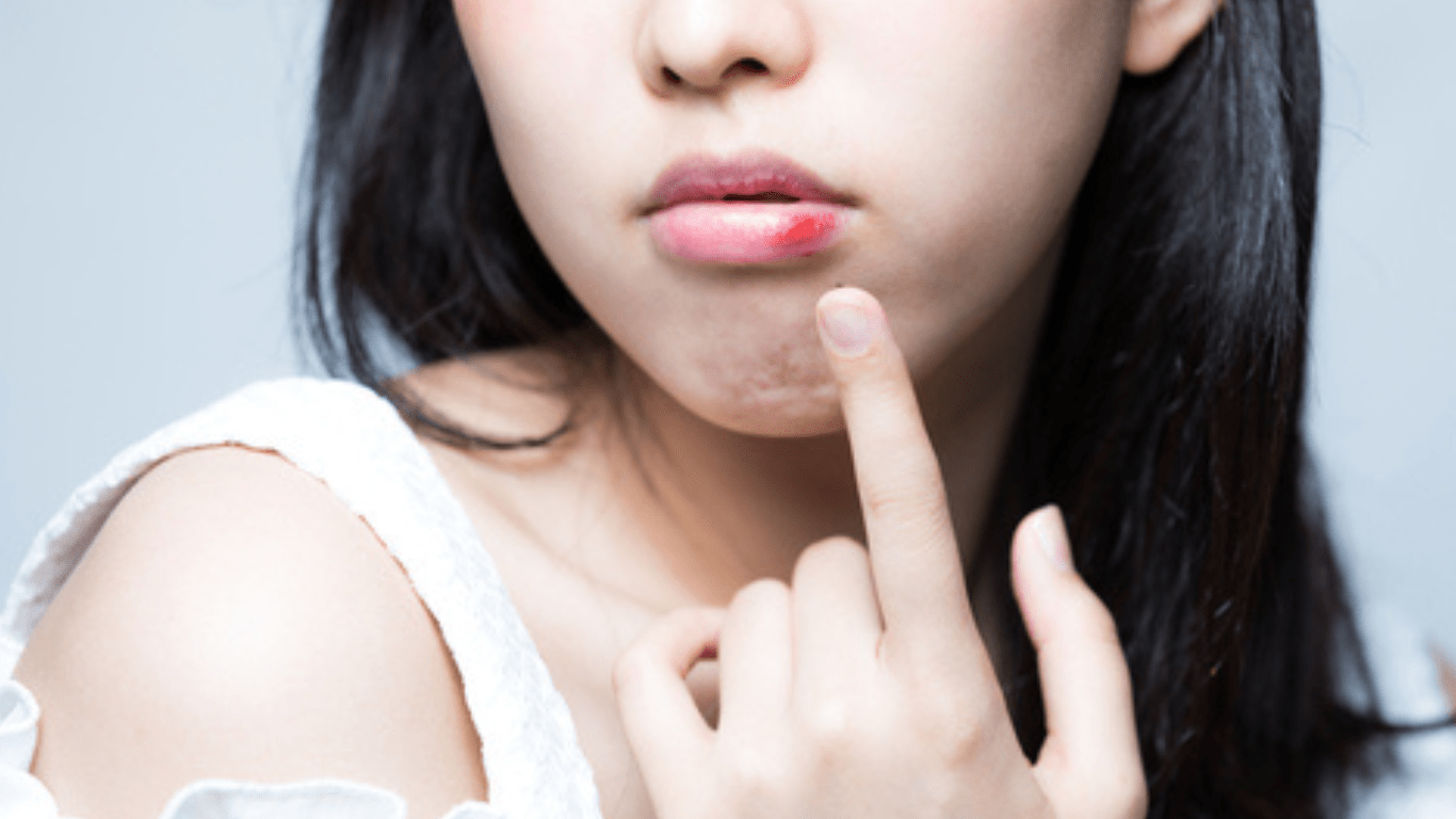 HSV: Understand the Types, Symptoms, and Treatment Options