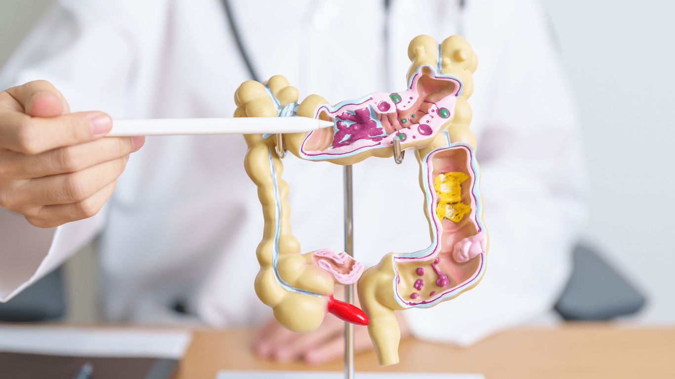 What is a Polypectomy?